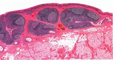 Histologia Da Tonsila Faringea Rotulada Fotomicrografia Da Faringe De